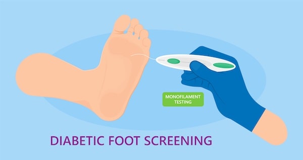 Diabetic Foot Exam: What to Expect?
